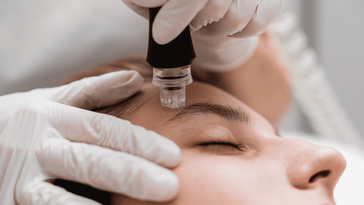 15 Effective Ways to Fix Hyperpigmentation